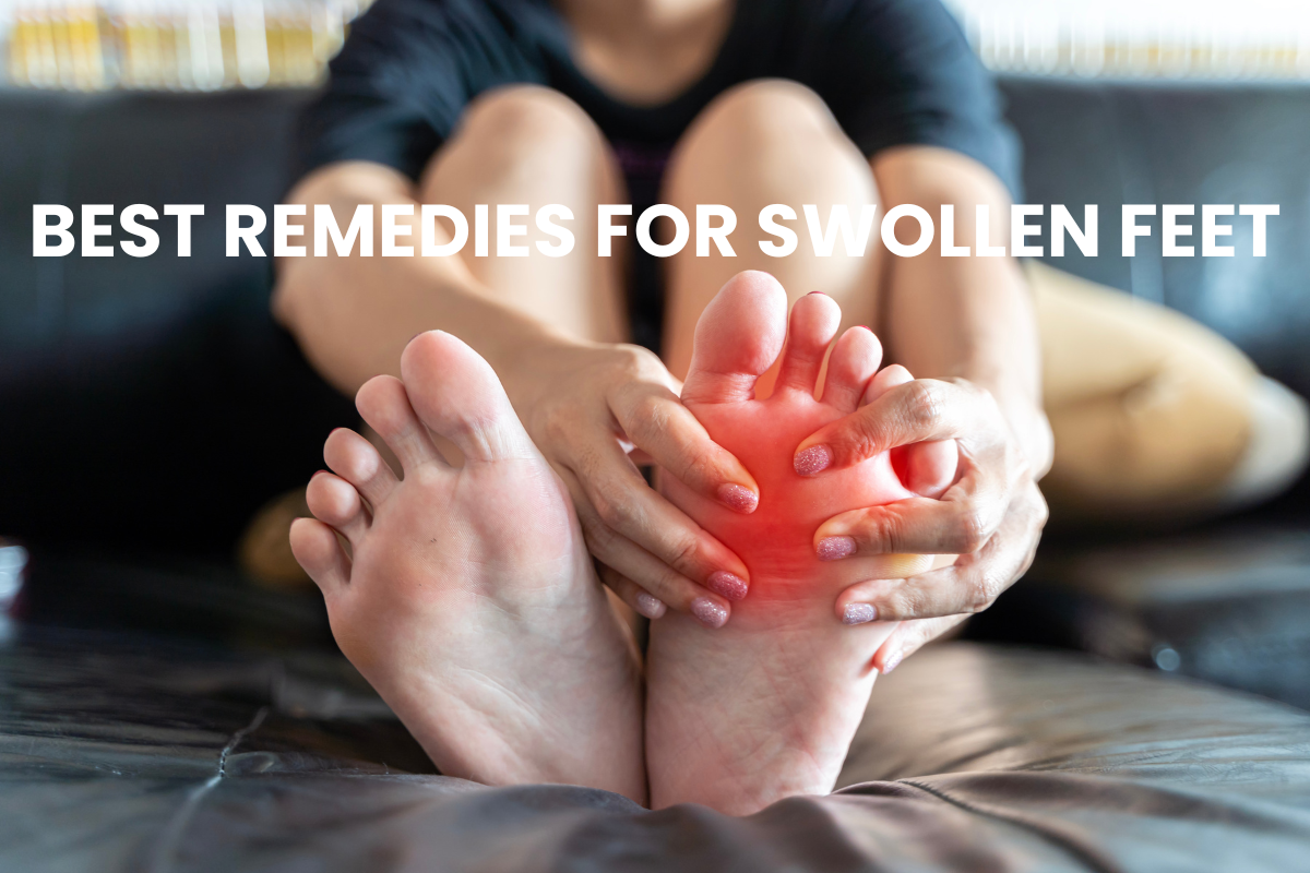 Best Remedies for Swollen Feet: Doctor-Recommended Treatments and Home